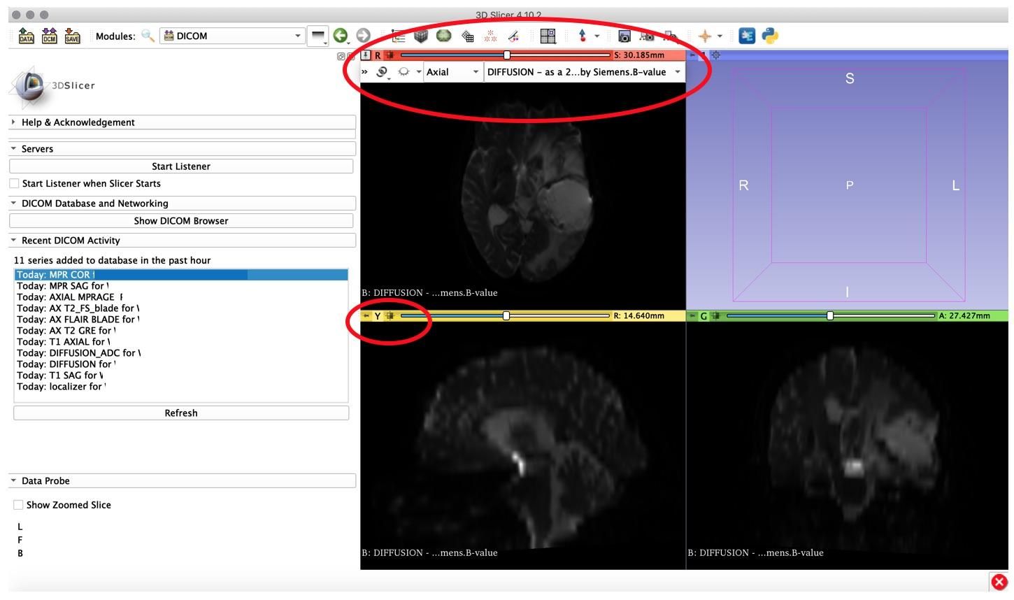 MRI to 3D Printable File (Artistic Approach) : 14 Steps (with Pictures ...