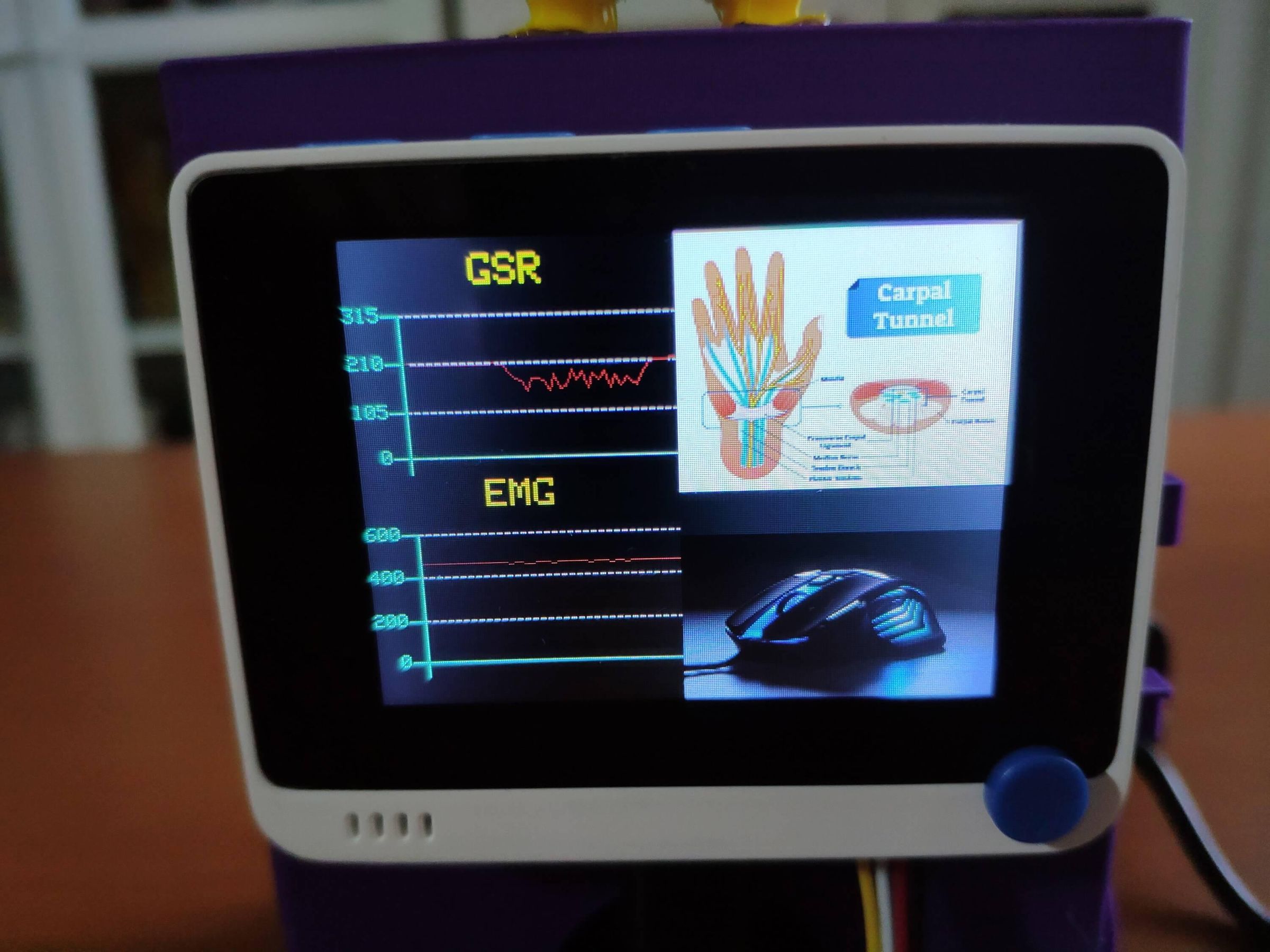 Mouse Fatigue Estimation by GSR and EMG Values W/ TensorFlow : 18 Steps ...