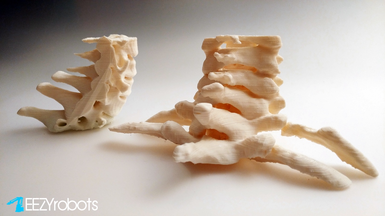 3D Printed Cervical Spine : 4 Steps (with Pictures) - Instructables