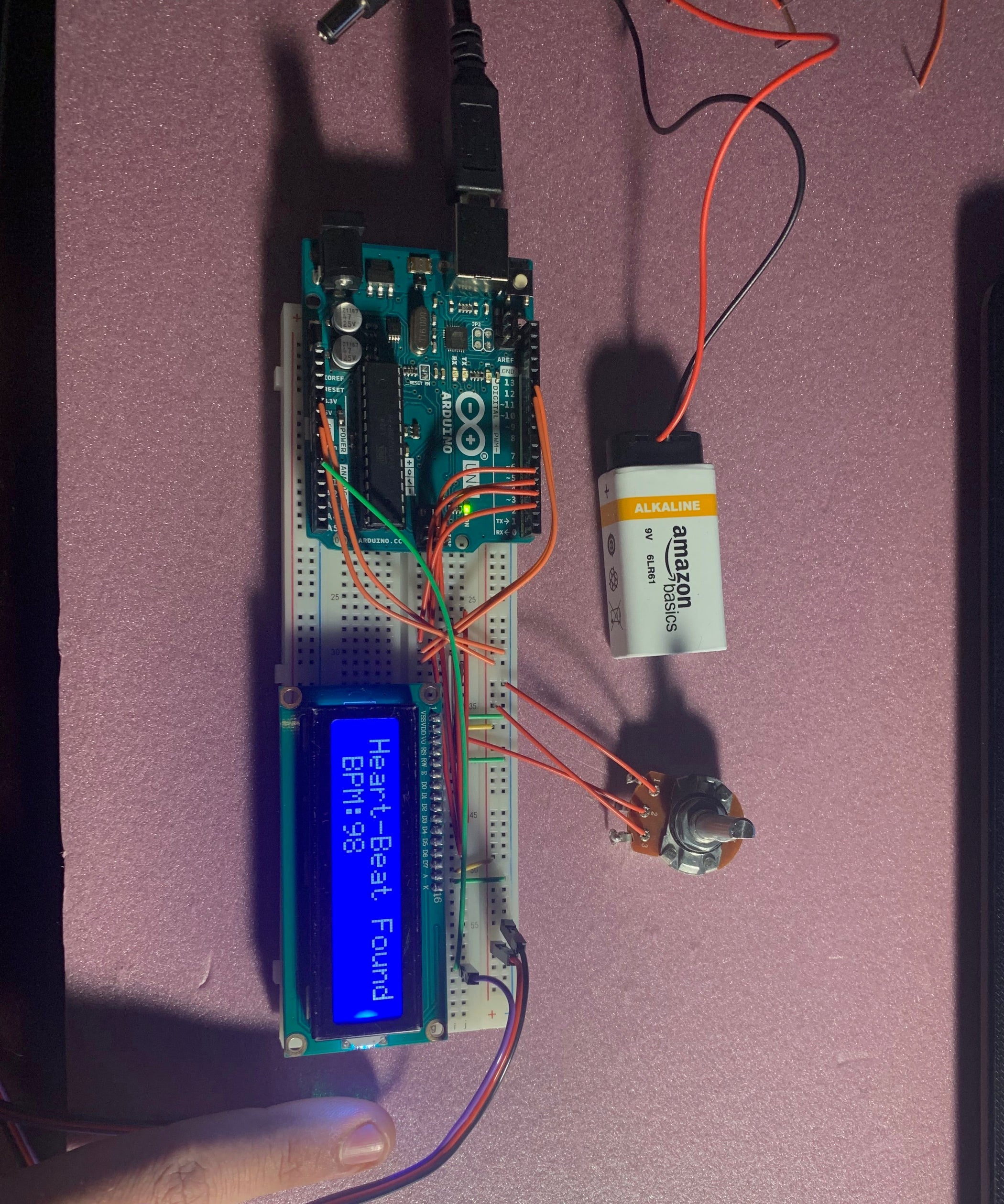 Rate Based Arrhythmia Detector Using Arduino : 7 Steps - Instructables