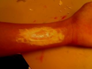 How to Make Yourself Into a Zombie! Realistic Wounds! : 10 Steps ...