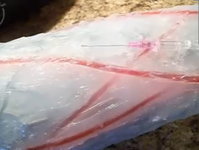 DIY IV Access Practice Arm With Flowing Blood : 11 Steps - Instructables