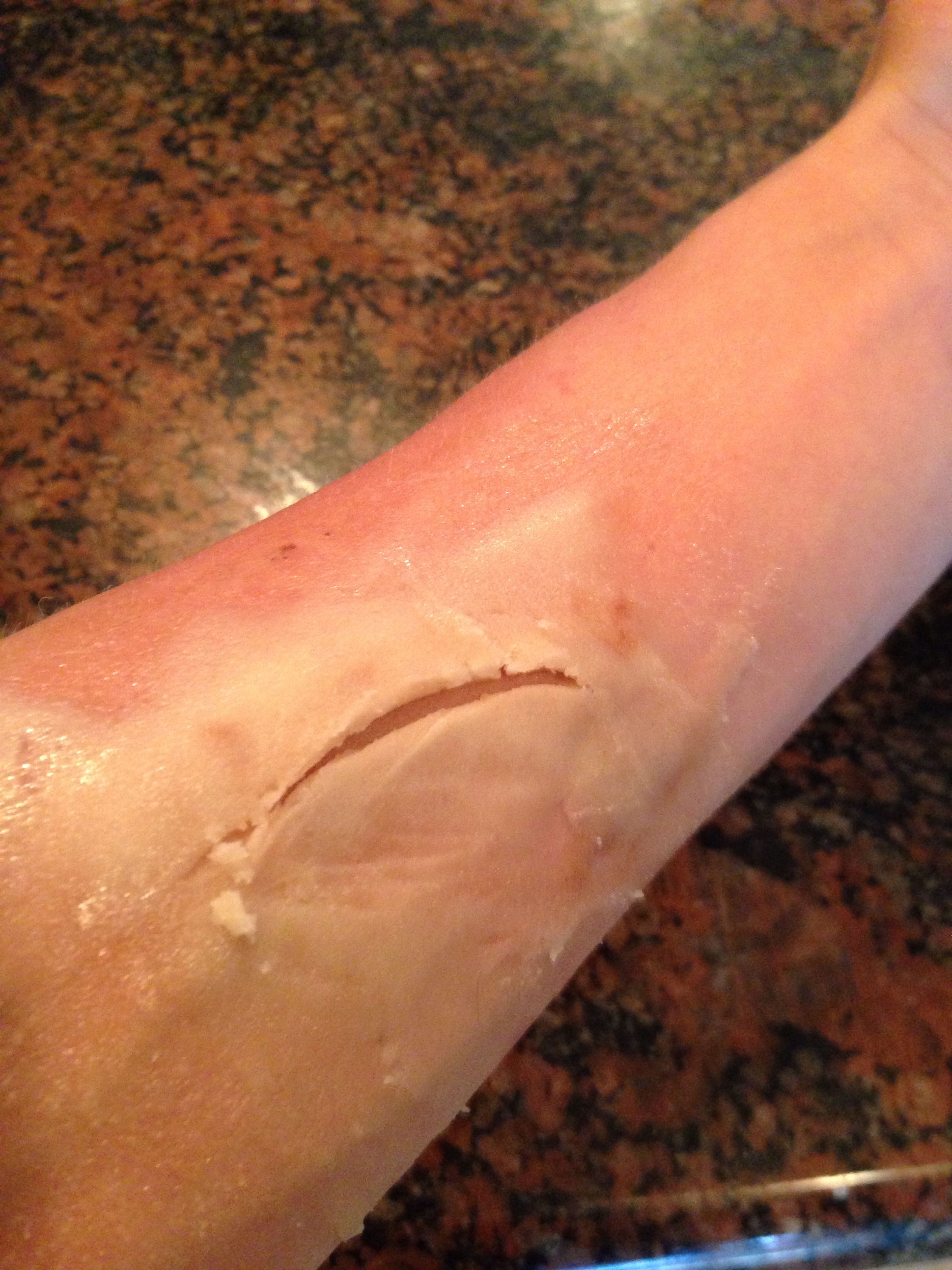Fake Wounds From Vaseline : 3 Steps - Instructables