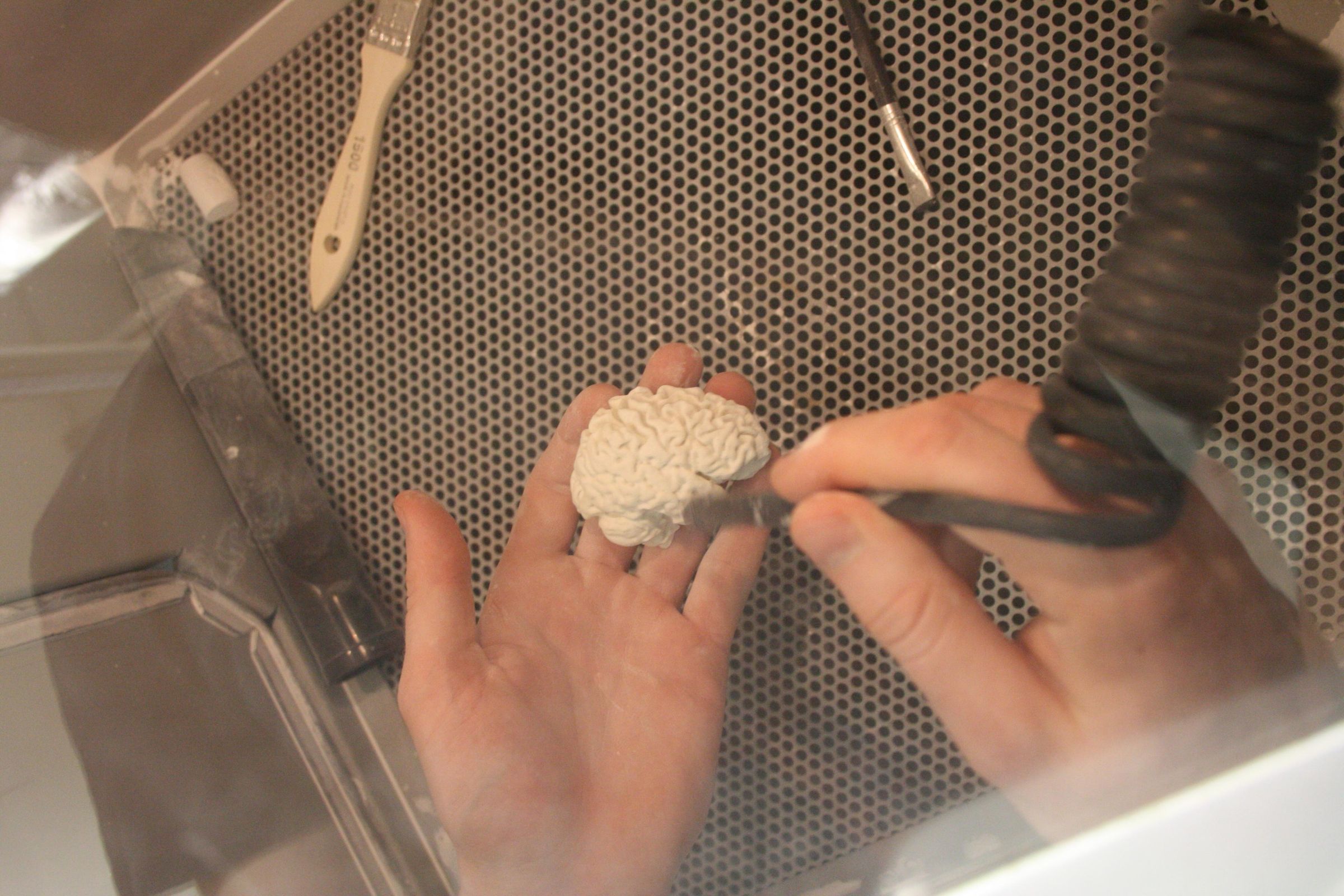 Edible Chocolate Brain From MRI Scan : 9 Steps (with Pictures ...