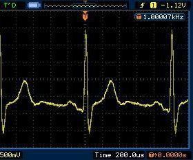 Make Your Own Electrocardiogram (ECG) : 6 Steps - Instructables