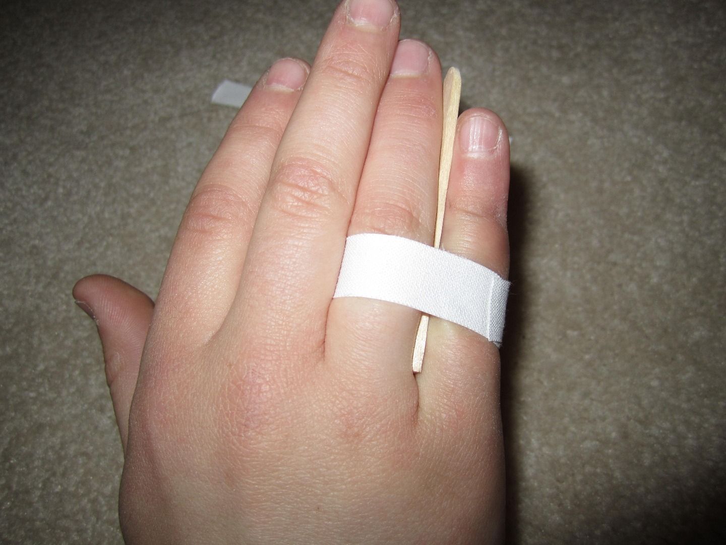 Easy Finger Brace : 4 Steps - Instructables