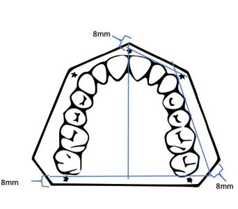 A New Method for Trimming Orthodontic Study Model : 8 Steps - Instructables