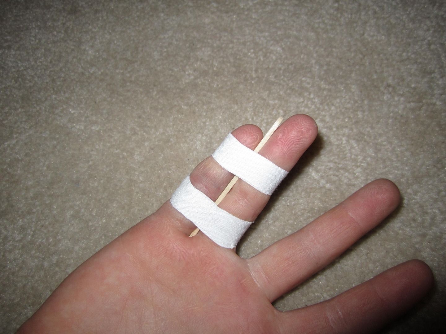 Easy Finger Brace : 4 Steps - Instructables