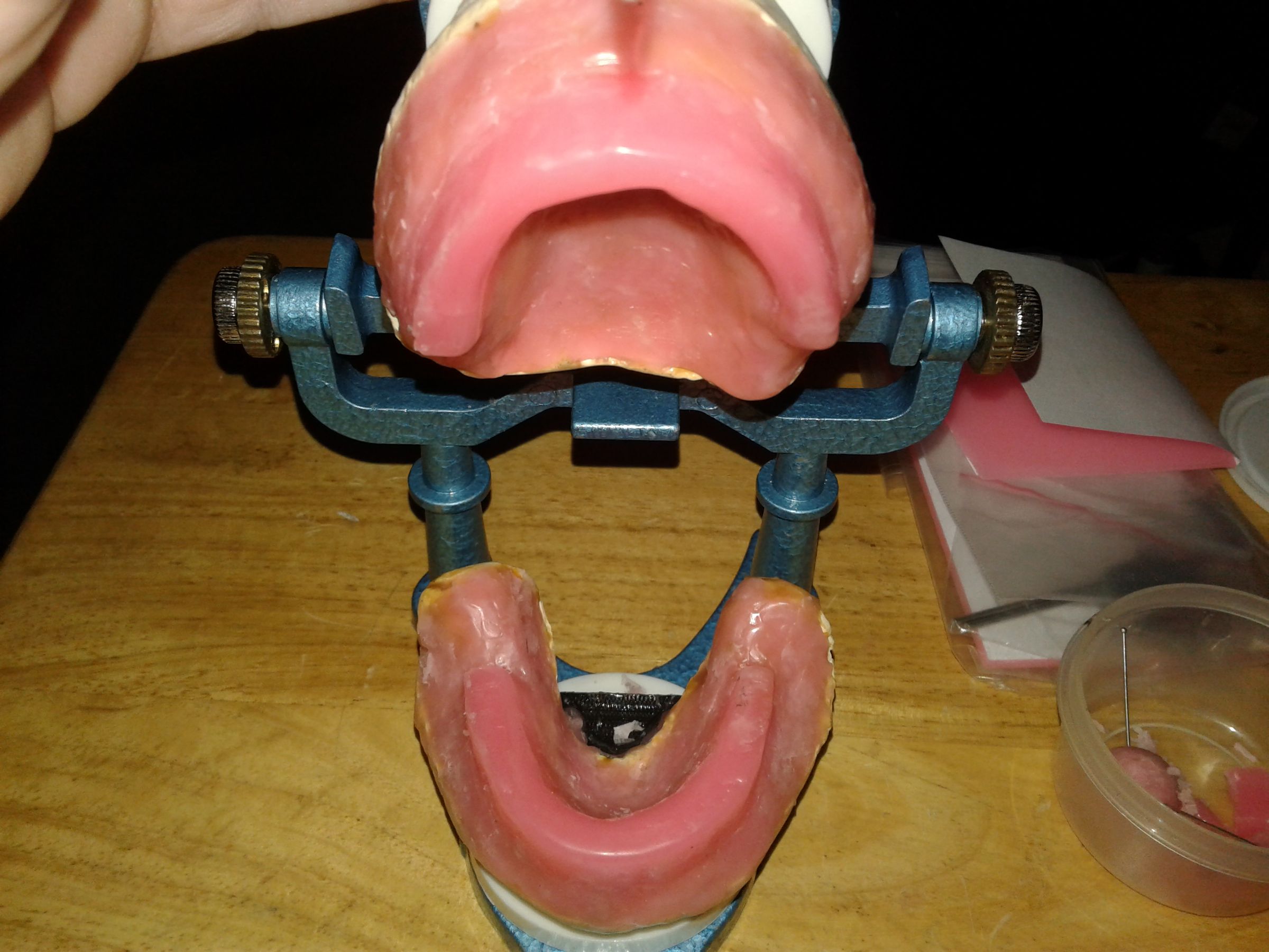 DIY Dentures : a Post-Surgical Plan : 12 Steps (with Pictures ...