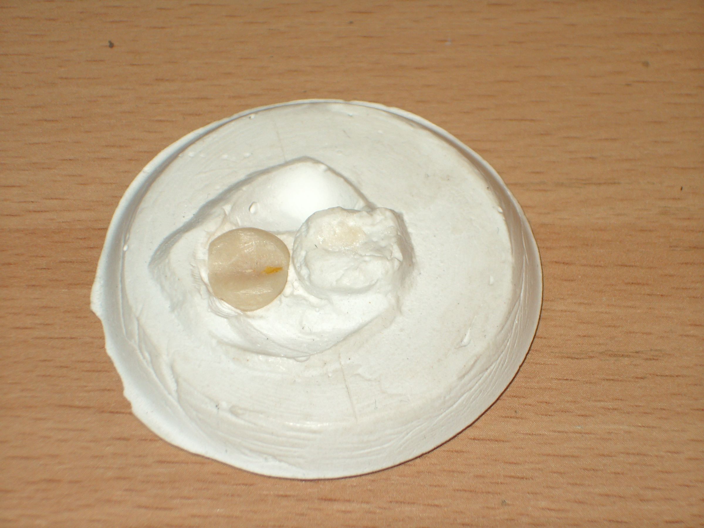 DIY Dentistry : 5 Steps - Instructables