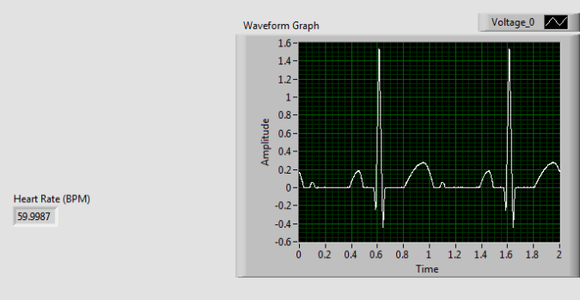 Simple ECG Recording Circuit and LabVIEW Heart Rate Monitor : 5 Steps ...