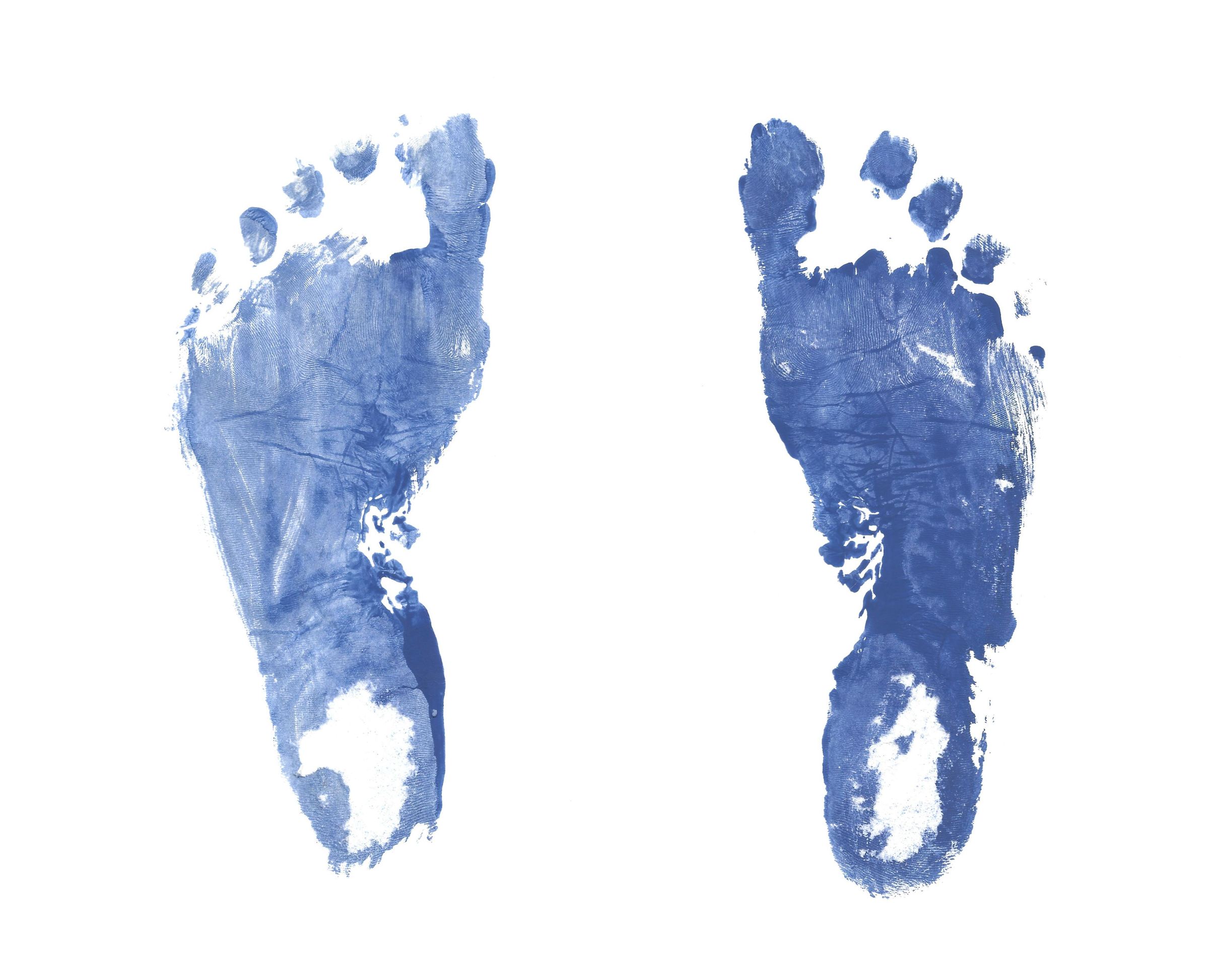 3D Print Custom Arch Supports : 7 Steps (with Pictures) - Instructables