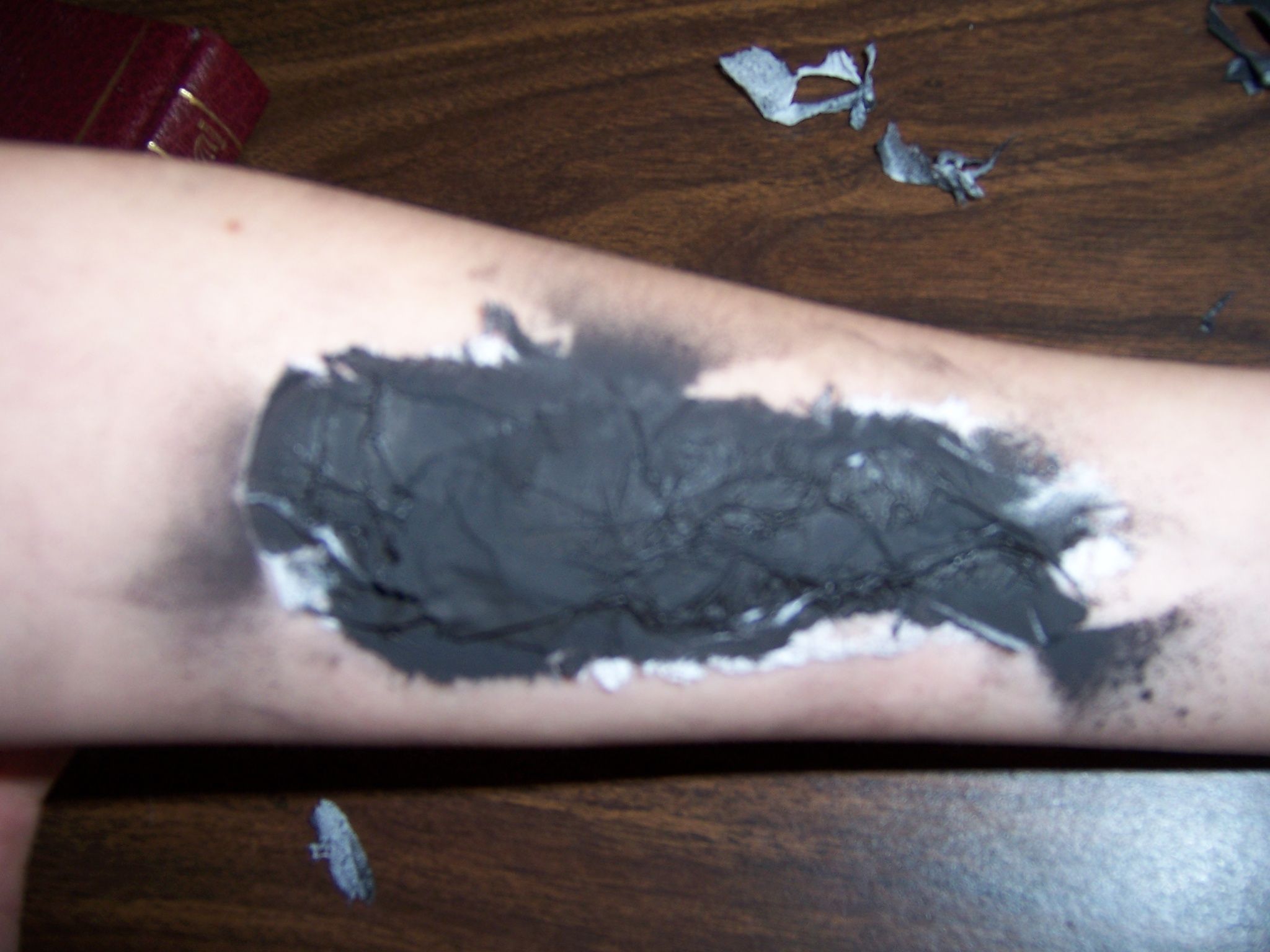 3rd Degree Burn Makeup : 5 Steps (with Pictures) - Instructables