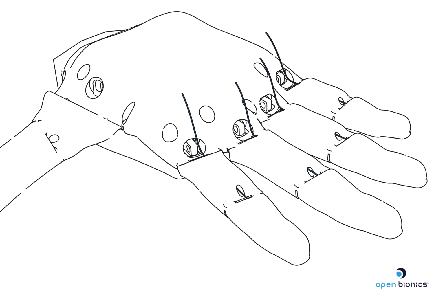 Ada Robotic Hand - Open Bionics : 8 Steps (with Pictures) - Instructables