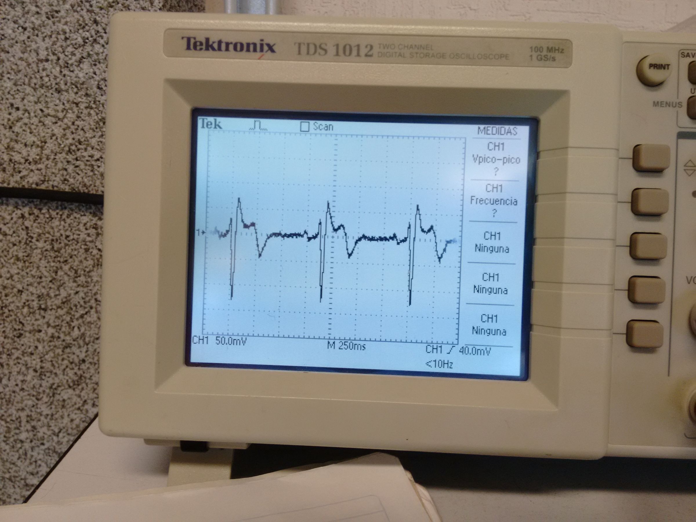DIY ECG + Arduino + LabView : 8 Steps - Instructables