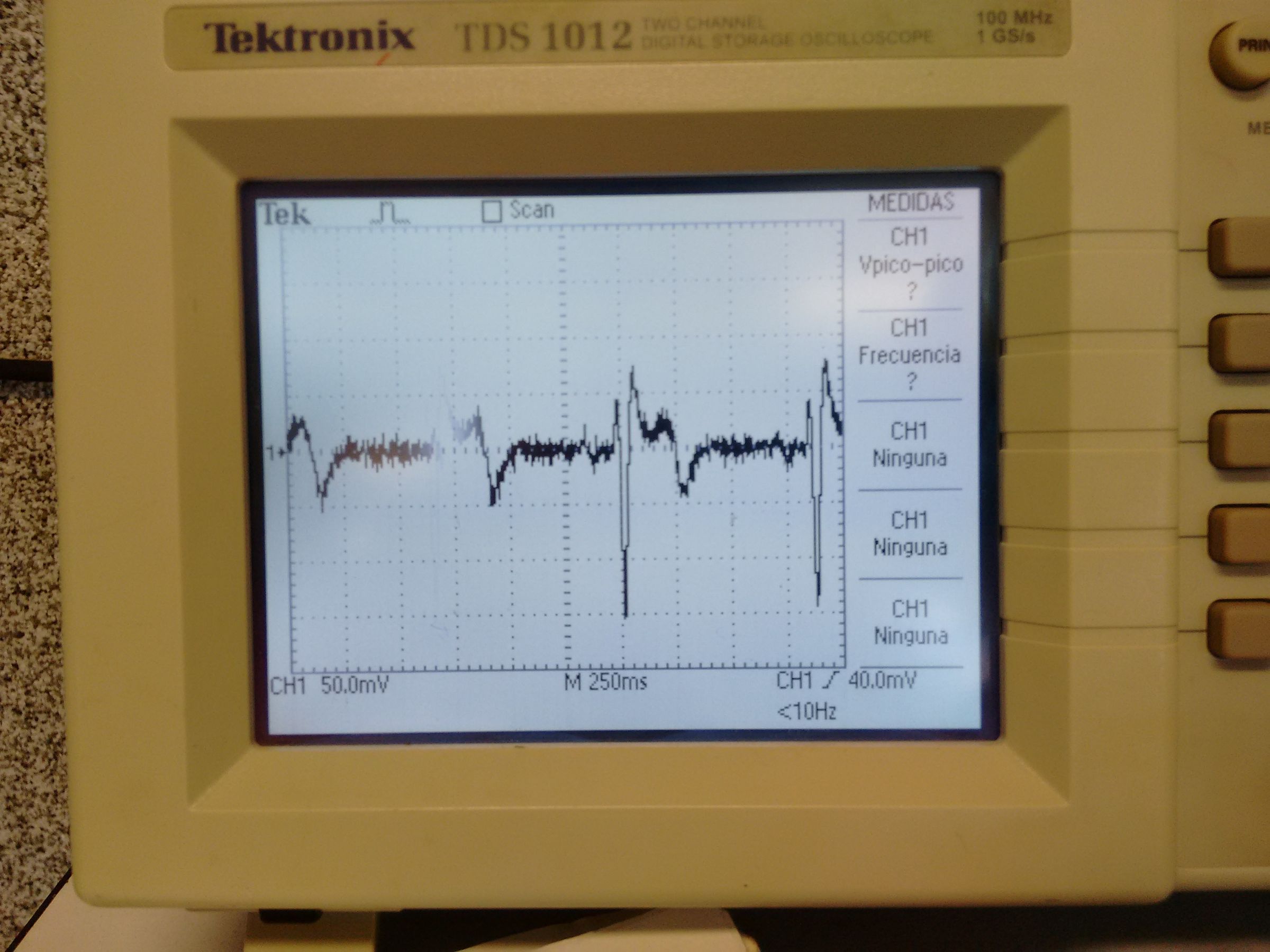 DIY ECG + Arduino + LabView : 8 Steps - Instructables