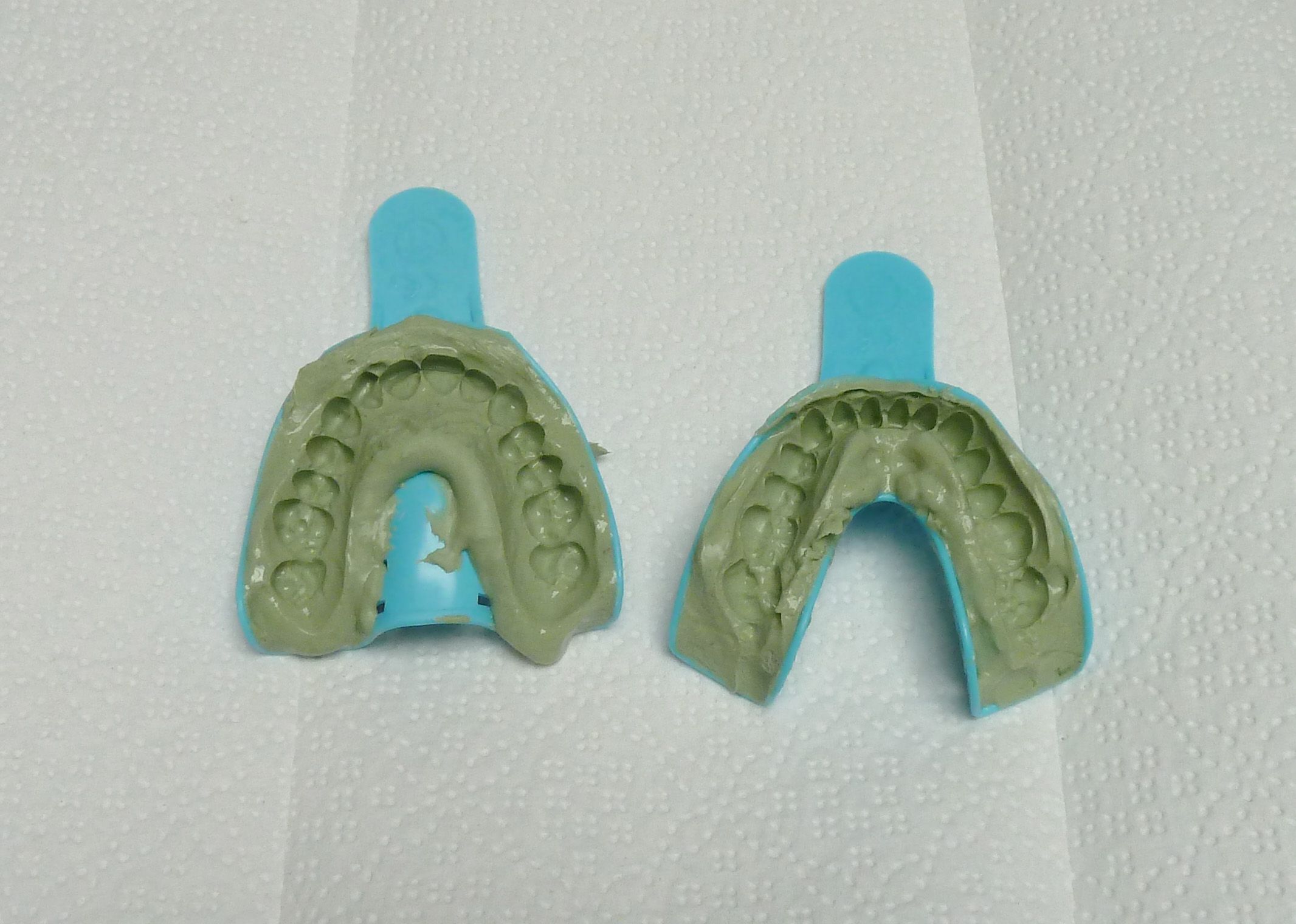 Cast Your Teeth for Halloween : 4 Steps (with Pictures) - Instructables