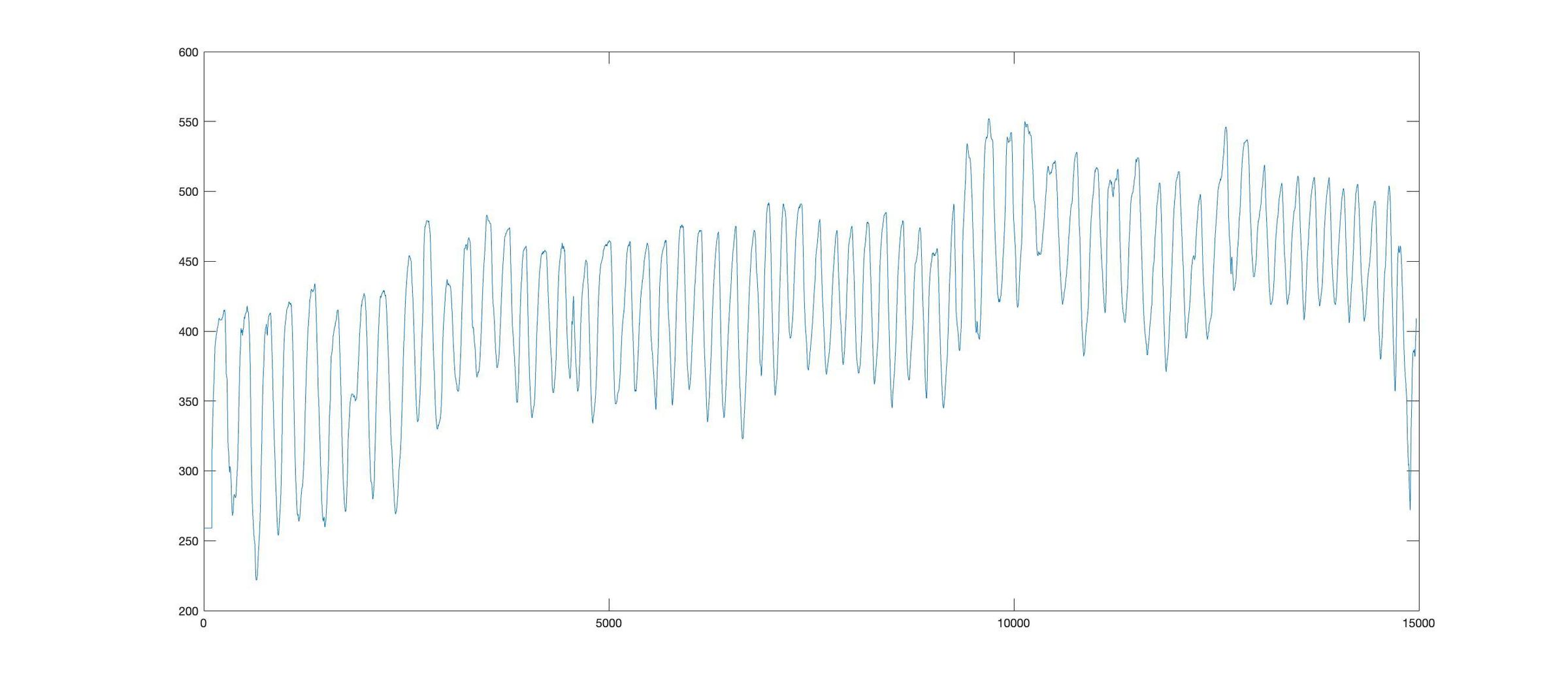 Breathing Sensor: Pneumograph Strelnikov-Stepanova : 4 Steps (with ...
