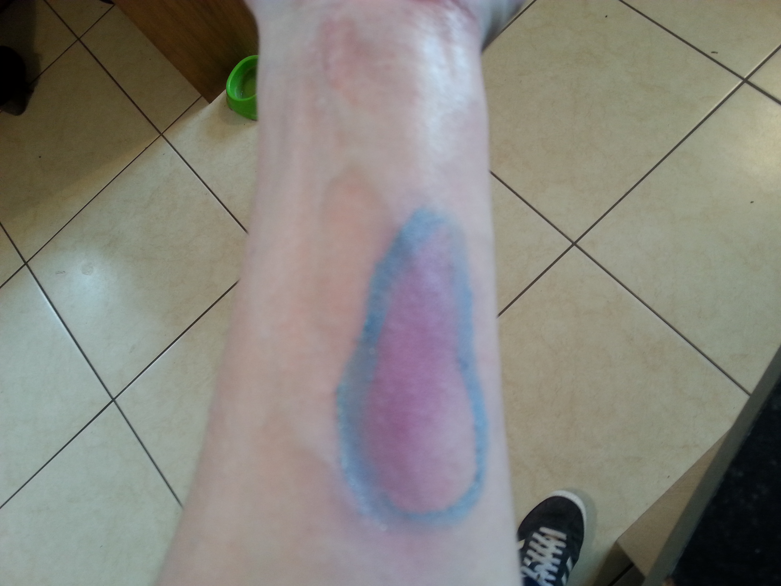 How to Create a Fake Halloween Bruise at Home.! : 6 Steps - Instructables