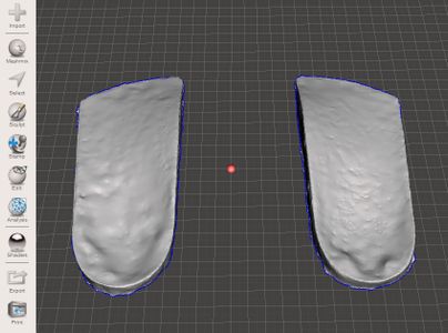 3D Printing Health: Custom DIY Orthotics : 13 Steps (with Pictures ...