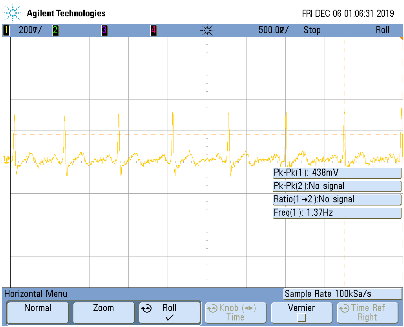 Design and Build an ECG Circuit | Trybotics
