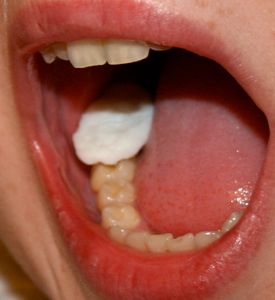 Using Clove to Cure Toothaches : 4 Steps (with Pictures) - Instructables