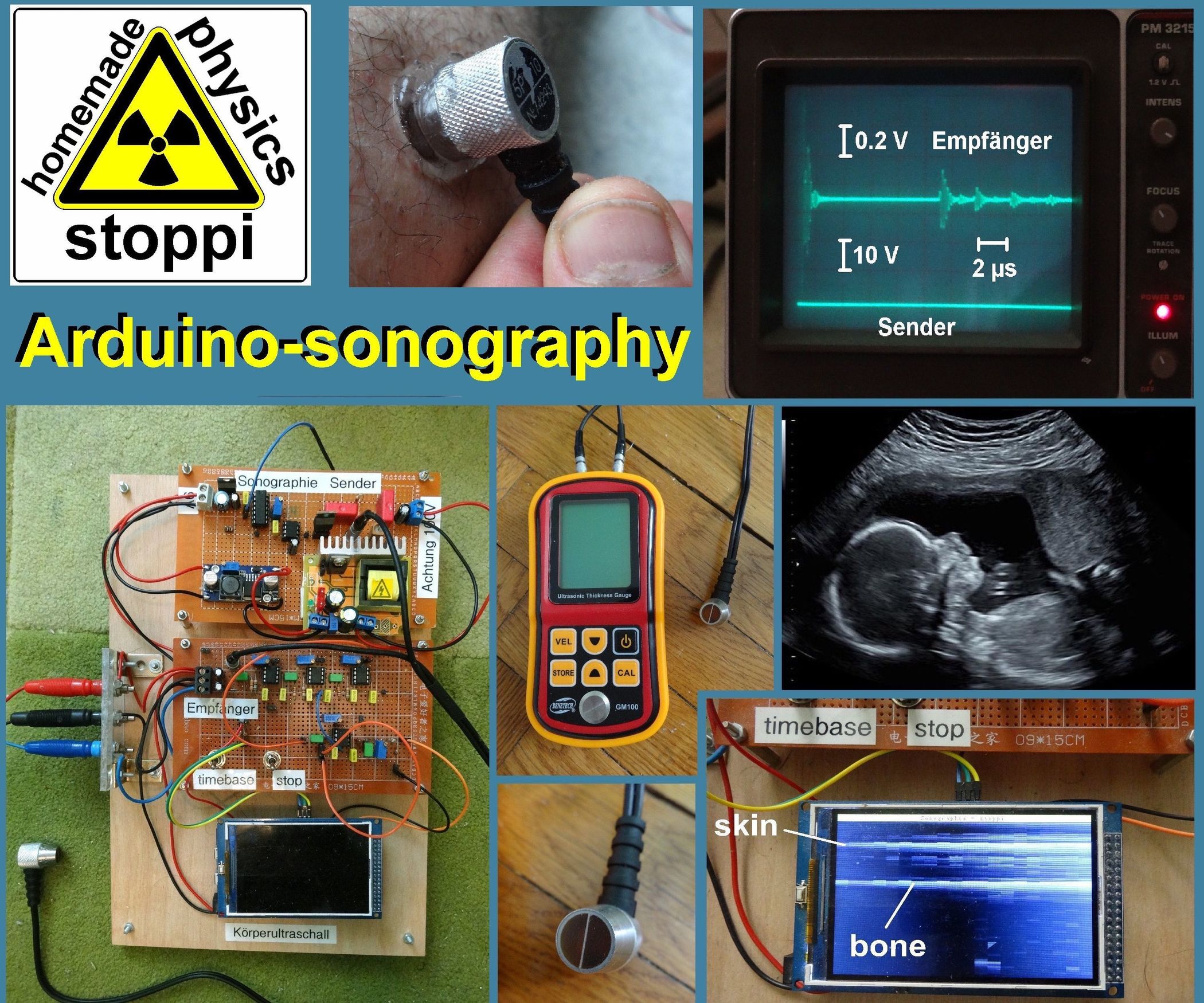 Body-ultrasound Sonography With Arduino : 3 Steps (with Pictures ...