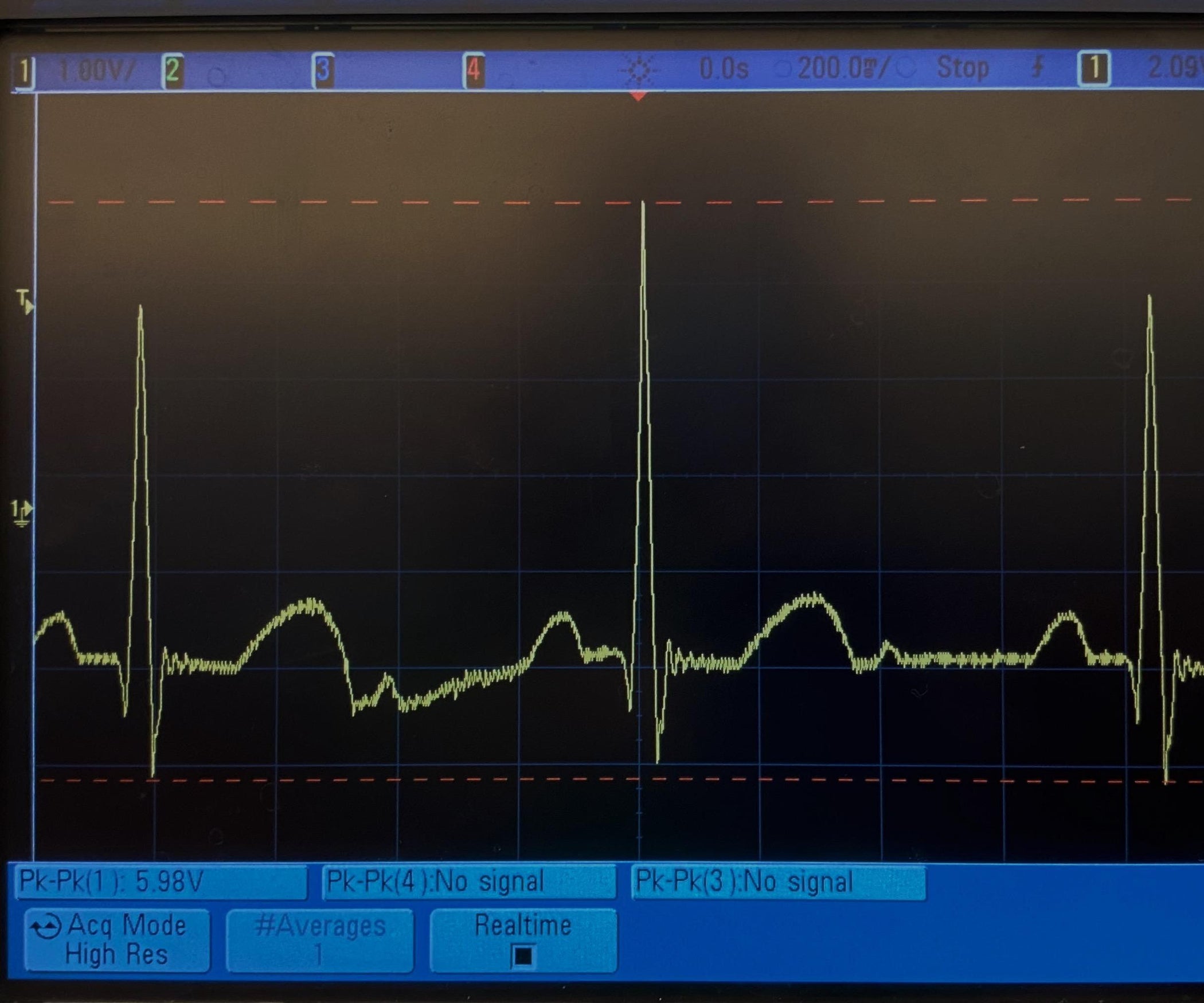 Electrocardiogram (ECG) Circuit Design : 6 Steps - Instructables