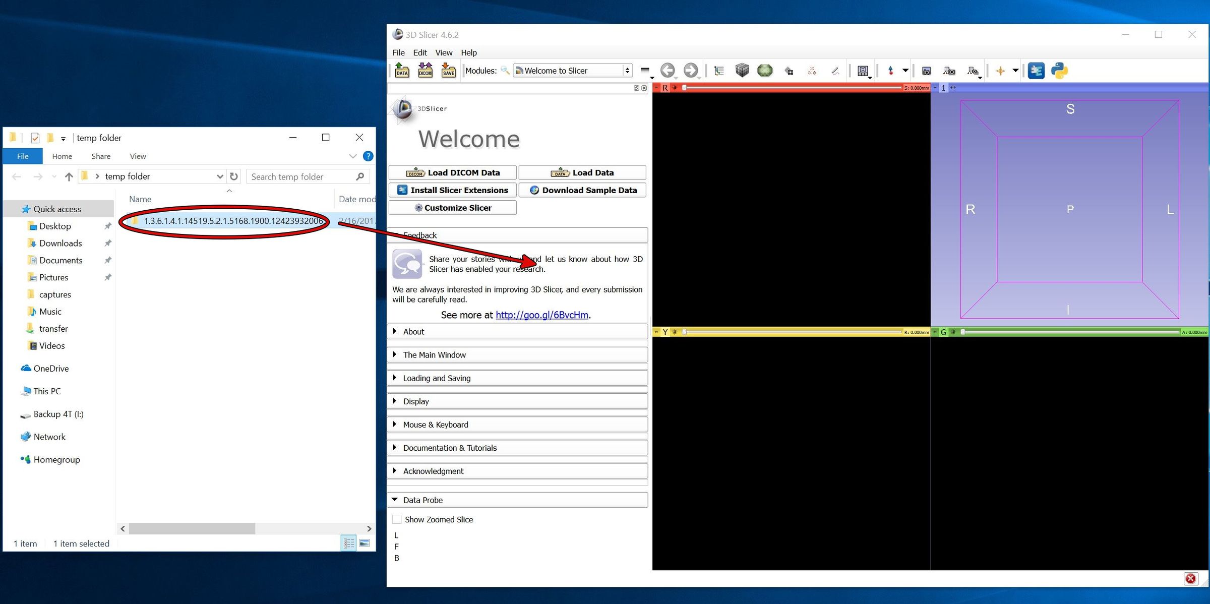 How to Easily and Automatically Convert a CT Scan (DICOM Data) Into a ...