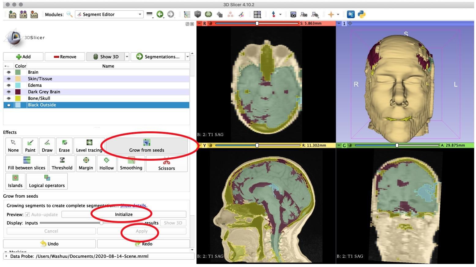 MRI to 3D Printable File (Artistic Approach) : 14 Steps (with Pictures ...
