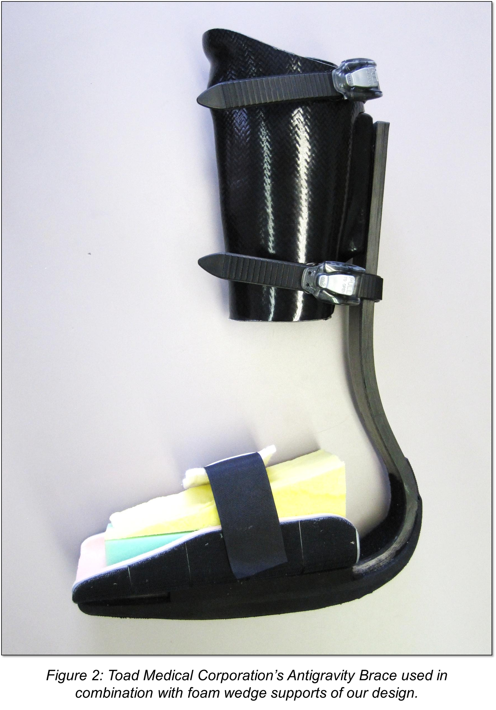 Improve the Toad Anti-Gravity Foot Brace ("TAG" Brace) : 6 Steps ...