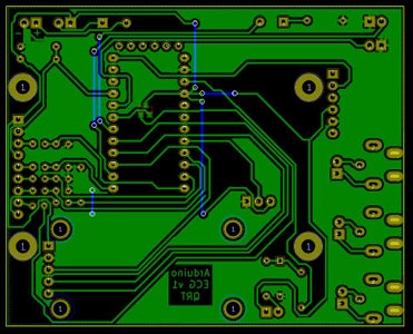 DIY ECG EKG Portable Heart Monitor : 8 Steps (with Pictures ...