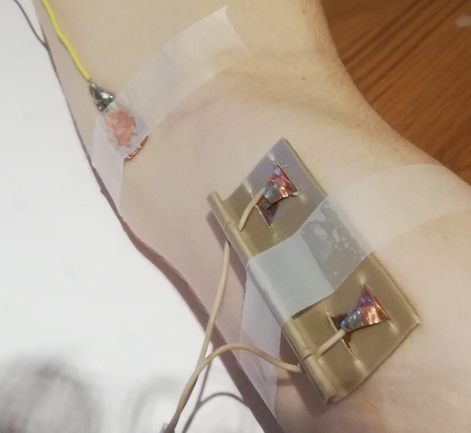 Simple Dry Electrode EMG for Arduino : 4 Steps - Instructables