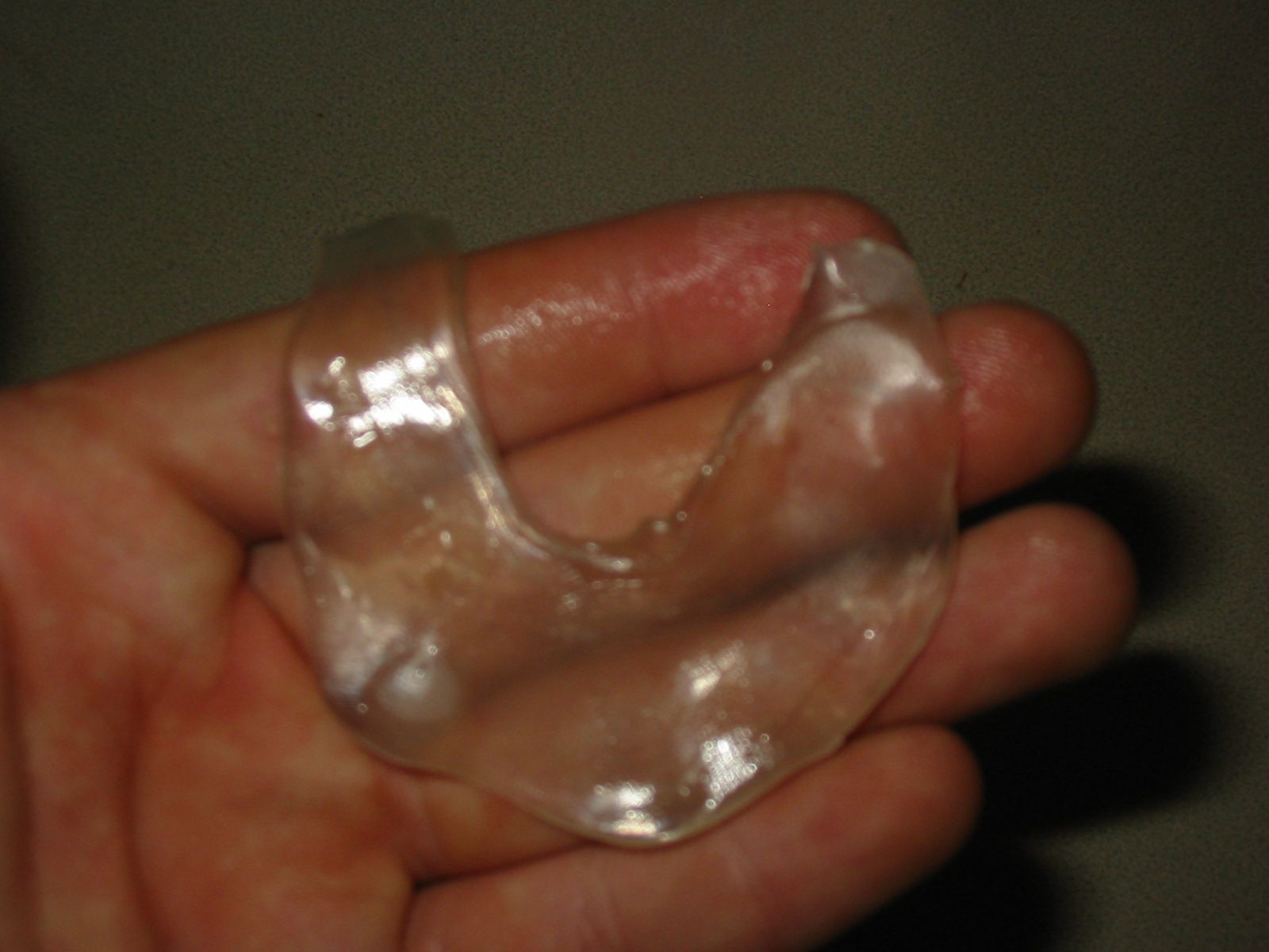 Make a Night Time Orthodontic Retainer : 3 Steps - Instructables
