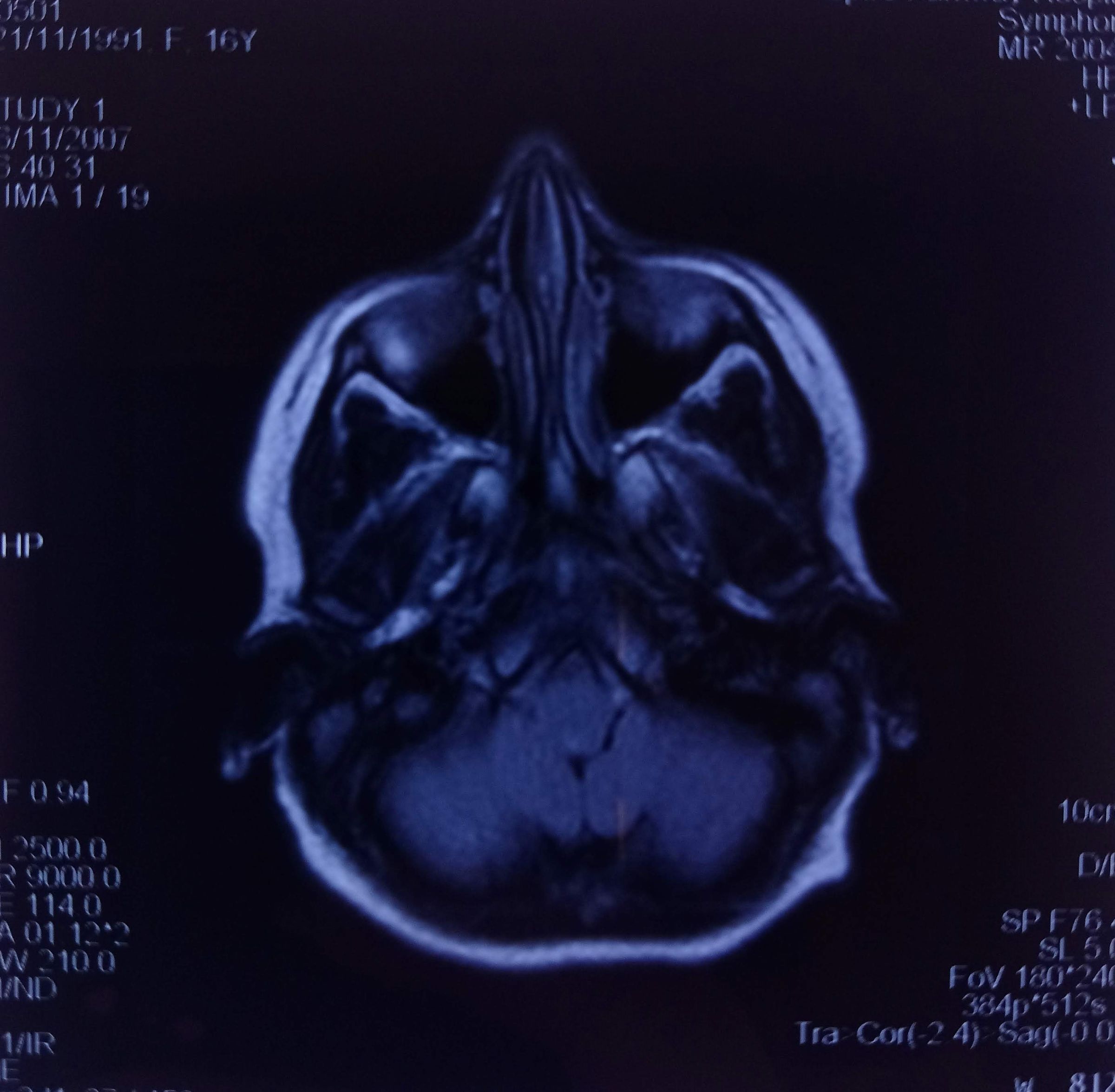 Mapping Your Mind- a Lesson on the Human Brain : 7 Steps - Instructables