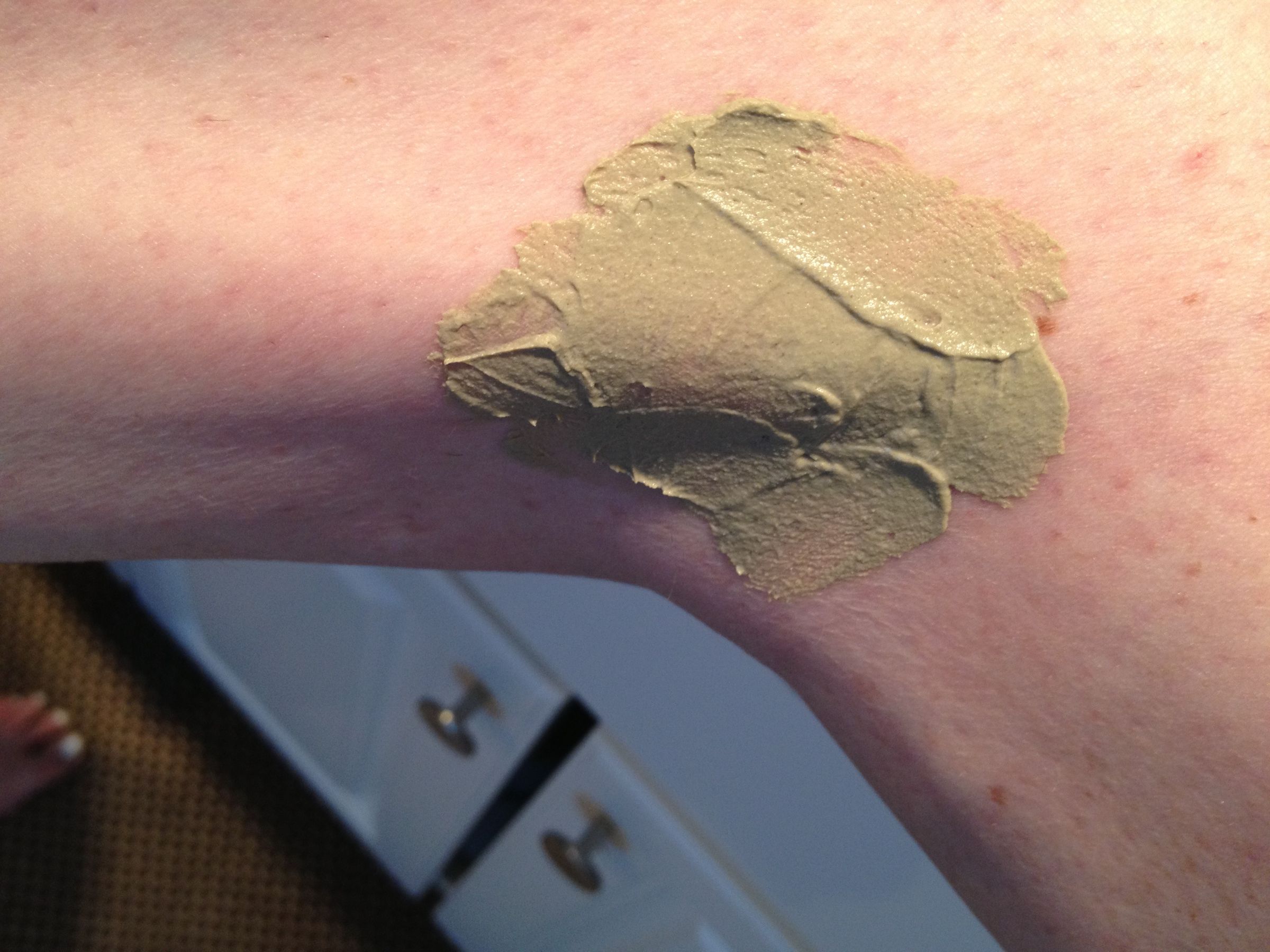 How to Get Rid of a Mosquito Bite : 6 Steps - Instructables