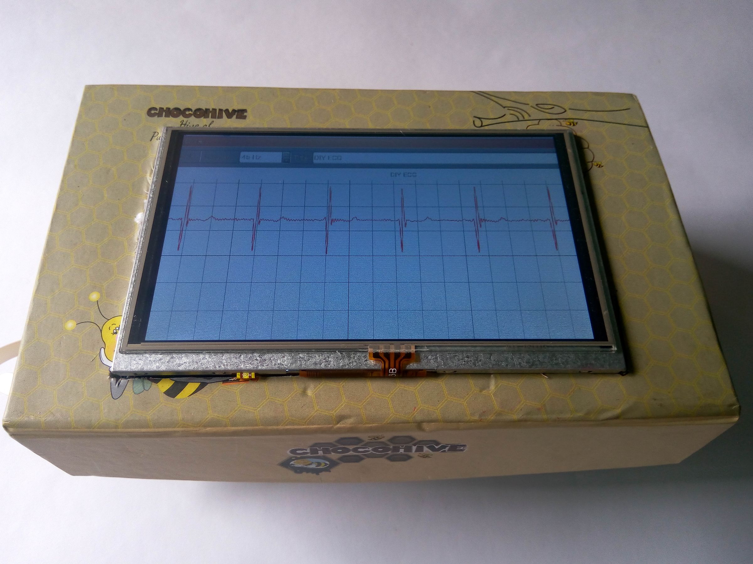 Portable ECG Machine : 9 Steps (with Pictures) - Instructables