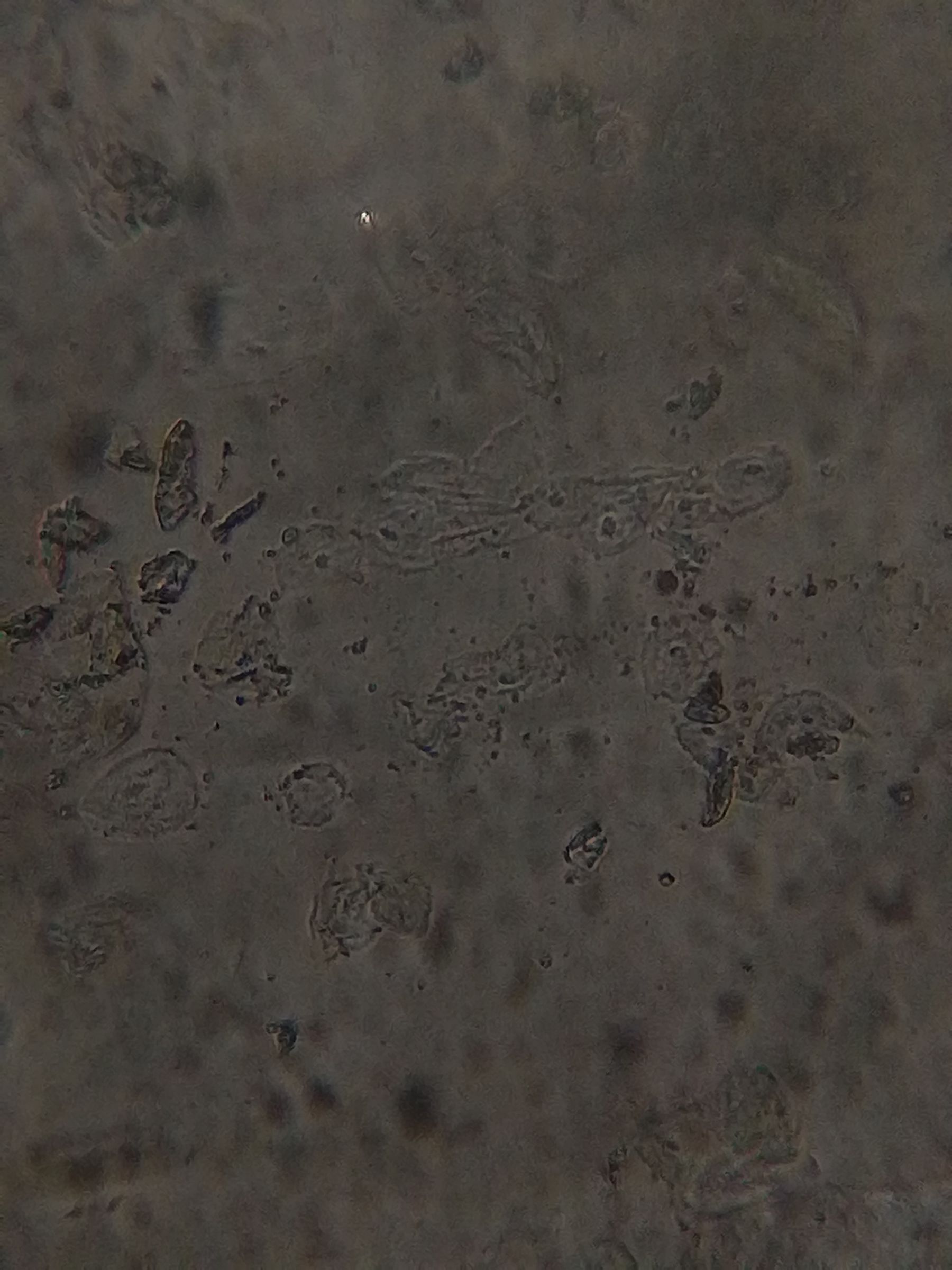 DIY X200 Microscope : 13 Steps (with Pictures) - Instructables