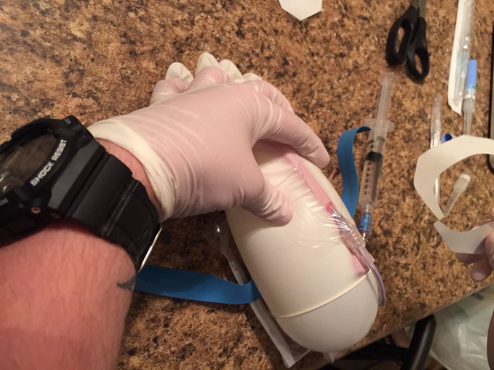 How to Insert a Saline Lock : 12 Steps - Instructables