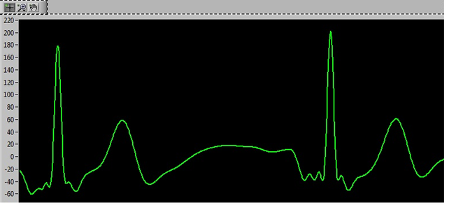 Arduino Based ECG & Heartbeat Monitoring Healthcare System : 8 Steps ...