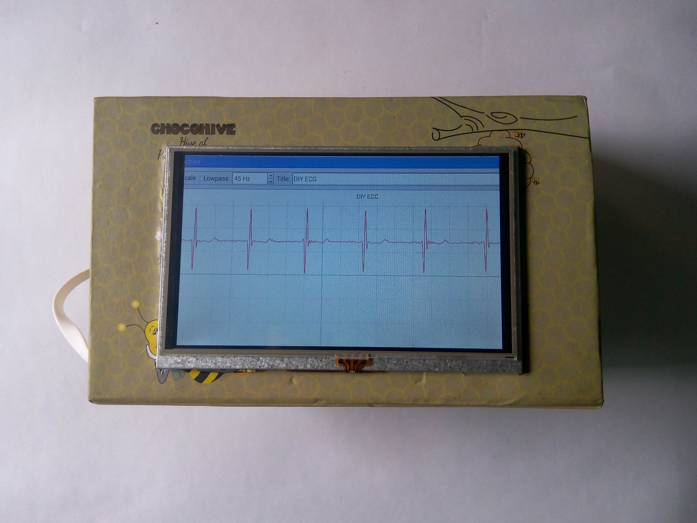 Portable ECG Machine : 9 Steps (with Pictures) - Instructables
