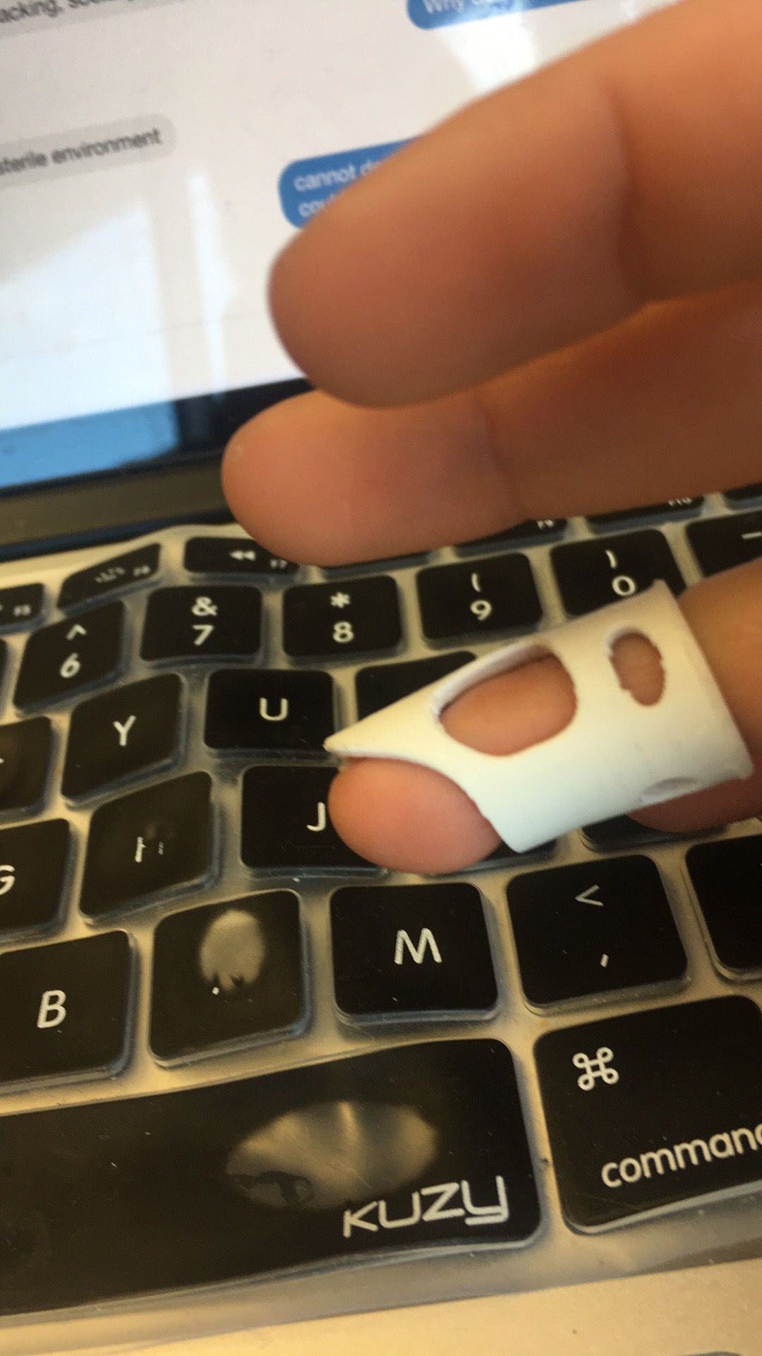 Custom 3D Printed Finger Splint : 3 Steps (with Pictures) - Instructables