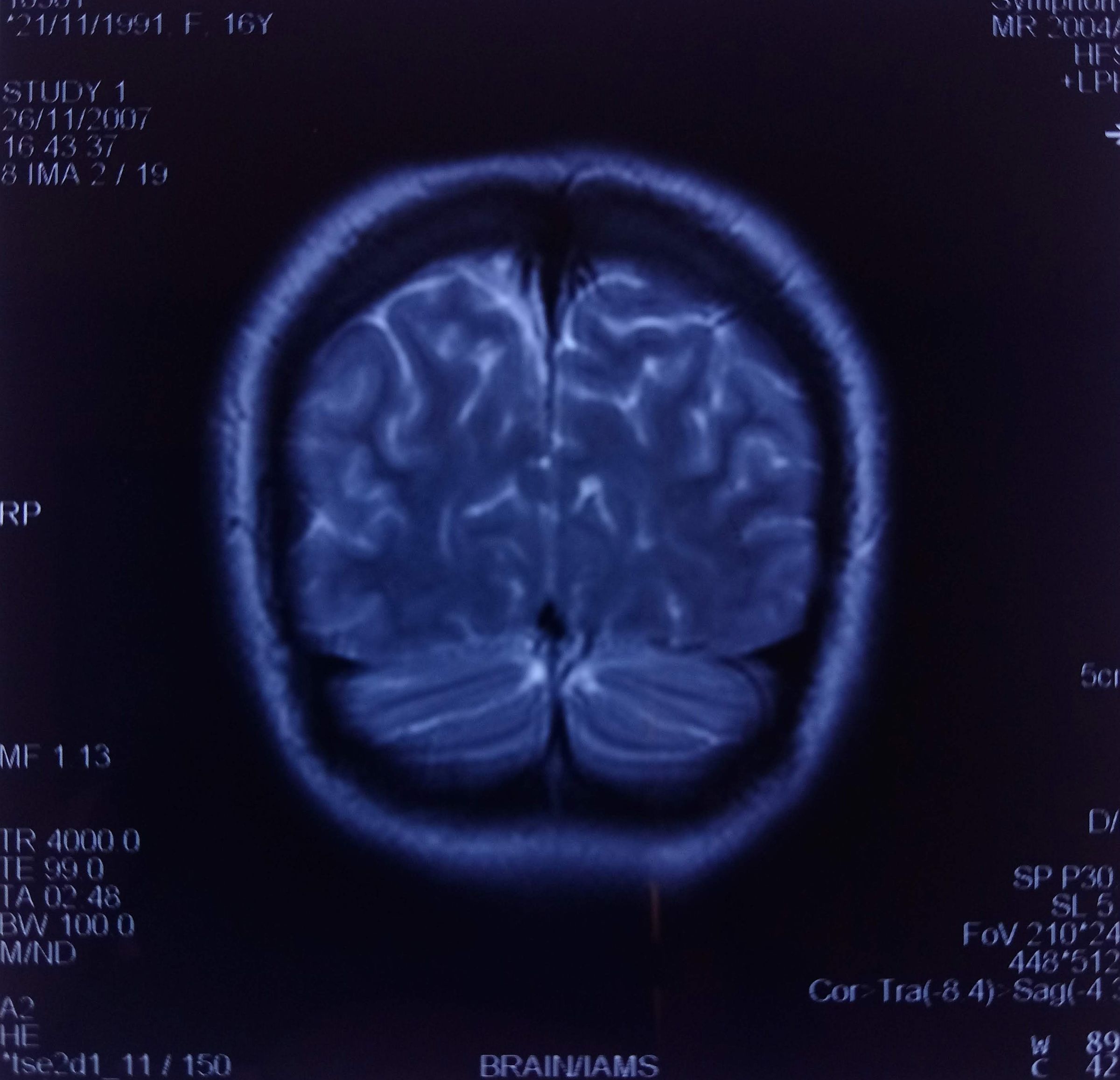 Mapping Your Mind- a Lesson on the Human Brain : 7 Steps - Instructables
