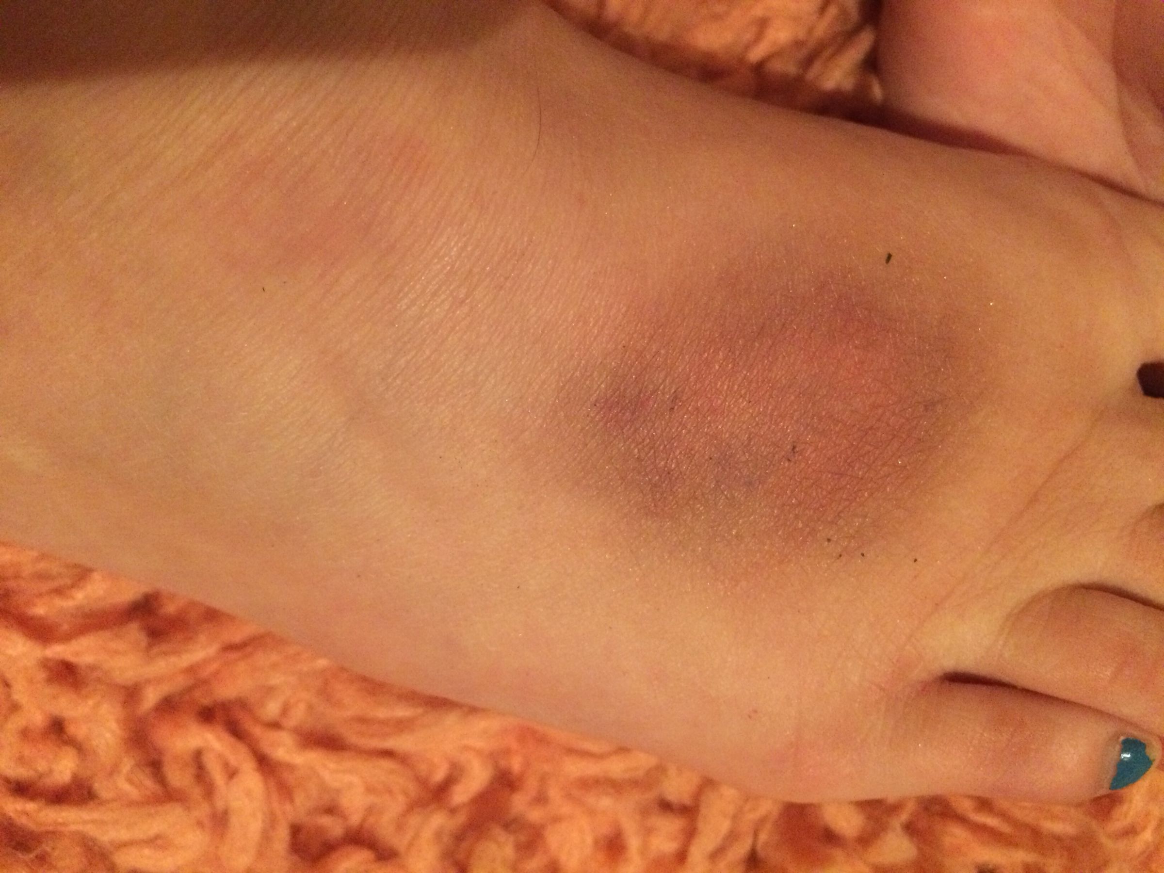 BRUISE MAKEUP : 5 Steps (with Pictures) - Instructables
