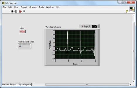 Electrocardiogram (ECG) Circuit : 7 Steps - Instructables