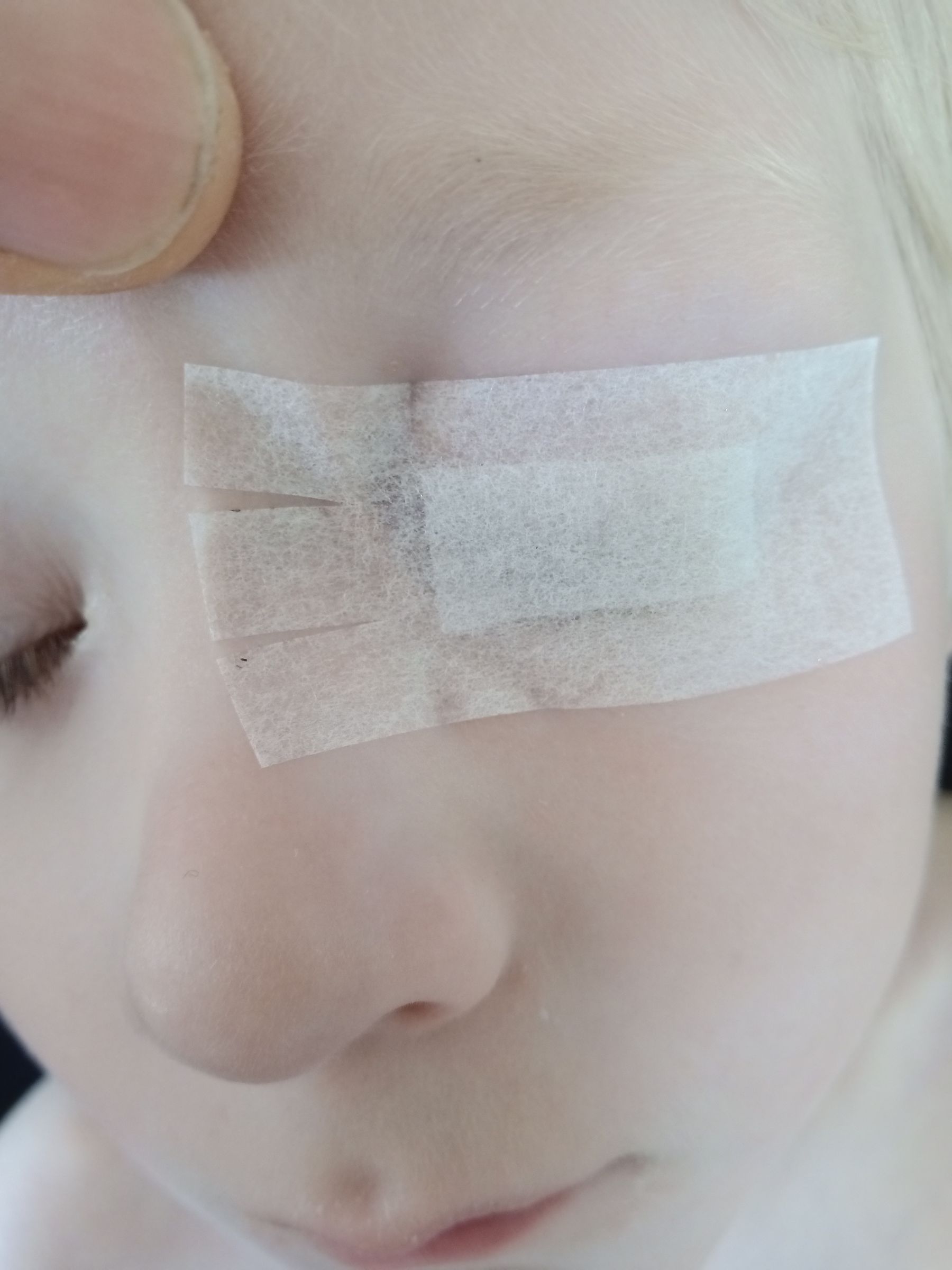 Easy Amblyopia Eye Patch - and Teaching Kids Money Saving : 6 Steps ...