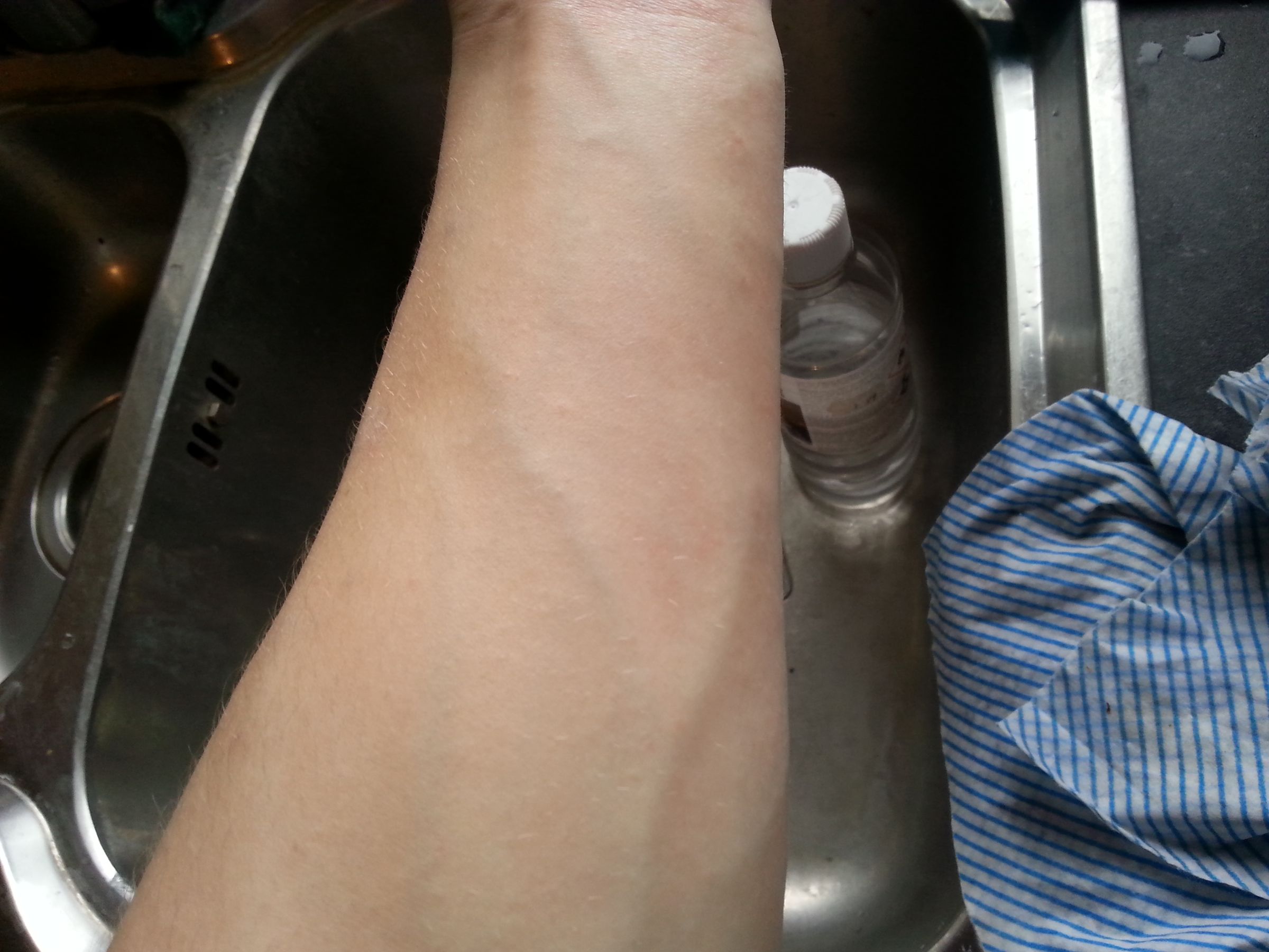 How to Create a Fake Halloween Bruise at Home.! : 6 Steps - Instructables