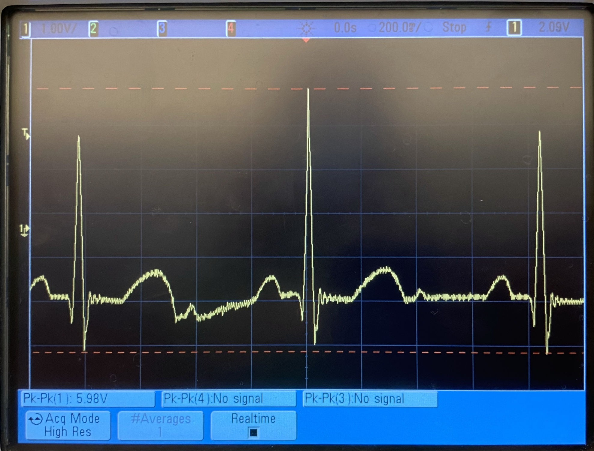 Electrocardiogram (ECG) Circuit Design : 6 Steps - Instructables