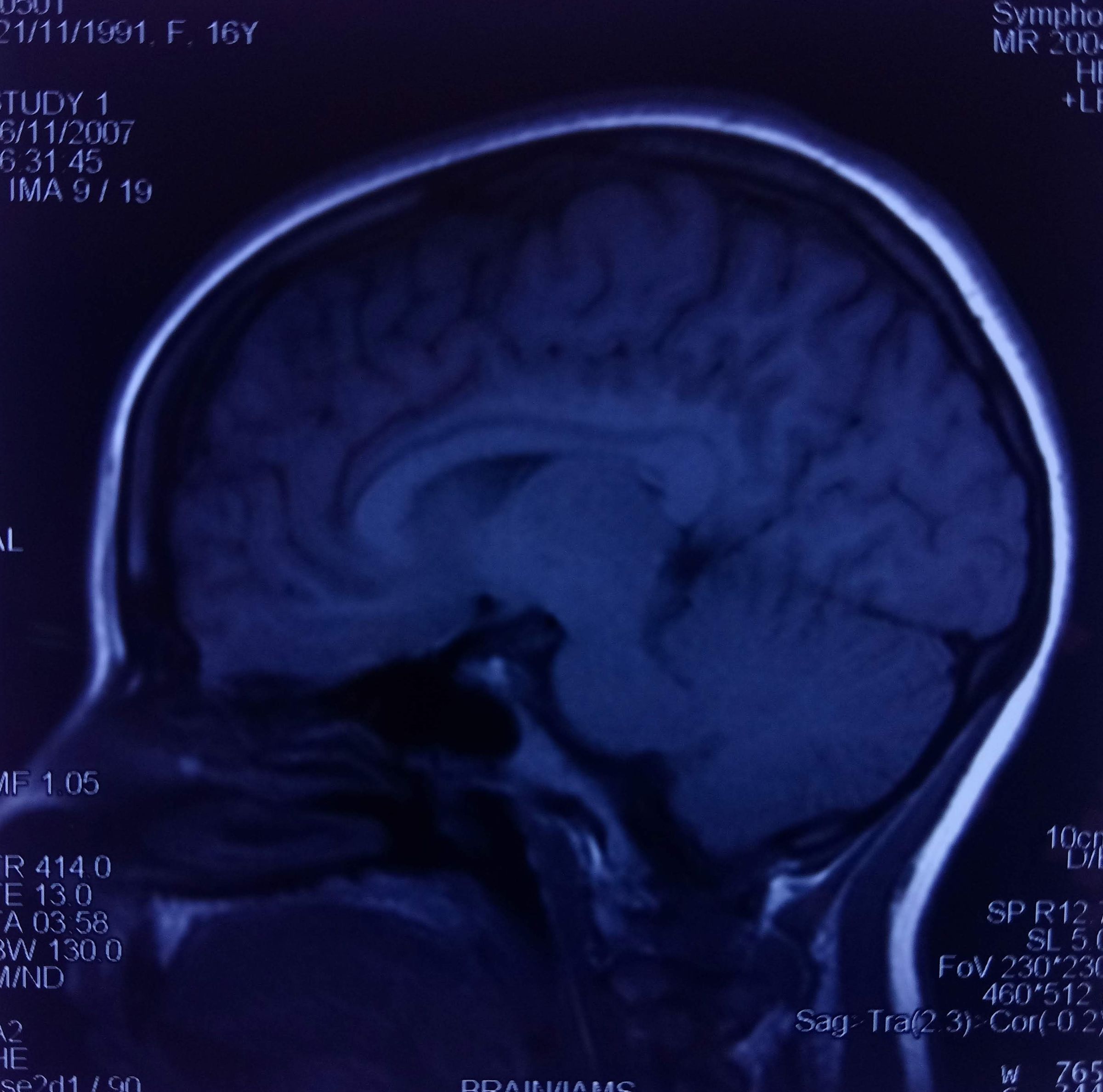 Mapping Your Mind- a Lesson on the Human Brain : 7 Steps - Instructables