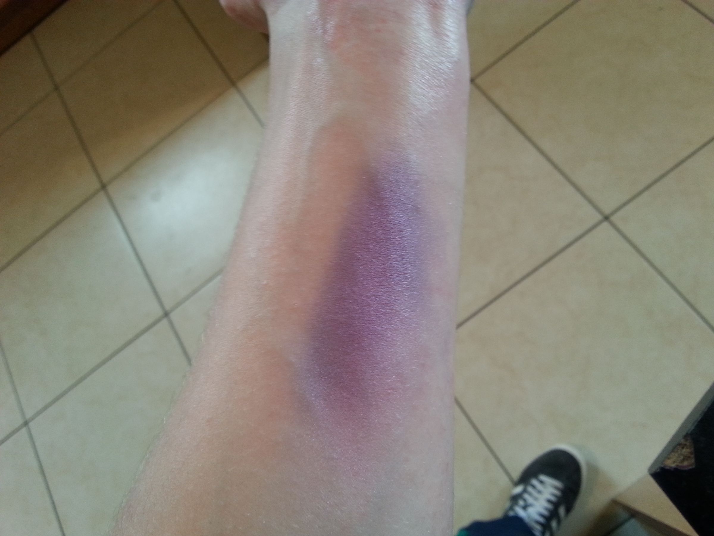 How to Create a Fake Halloween Bruise at Home.! : 6 Steps - Instructables